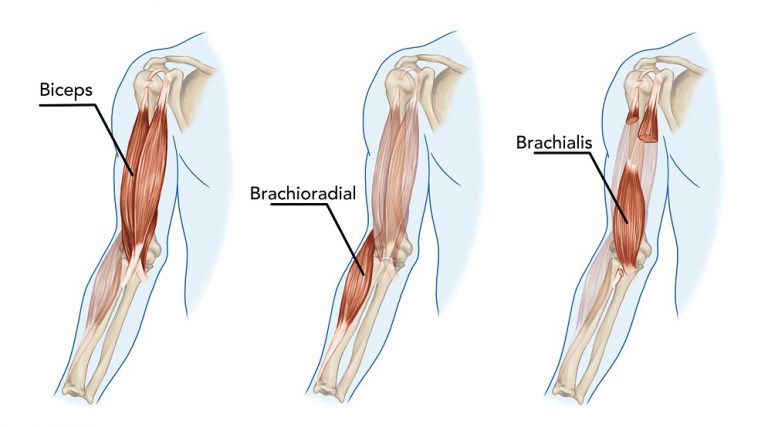 What Causes a Bicep to Tear: How to Prevent and Treatment Options - POP